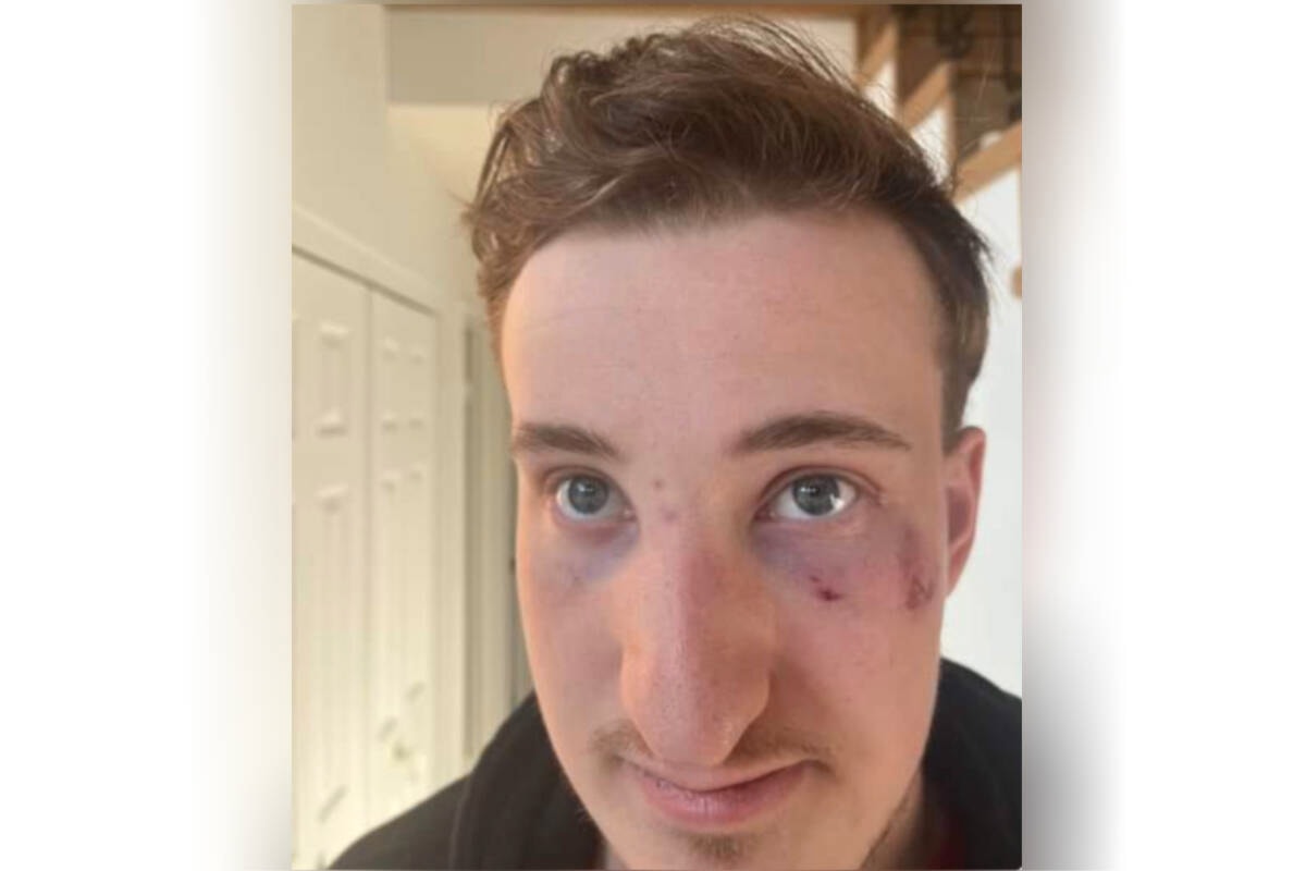 BCHL team bus driver allegedly attacks fan outside Salmon Arm arena ... BCHL team bus driver allegedly attacks fan outside Salmon Arm arena ...
